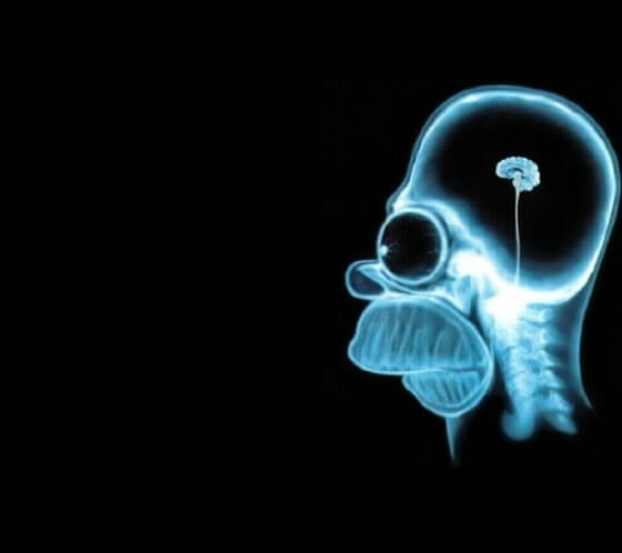 homer-simpson-brain • Alzheimer Universal